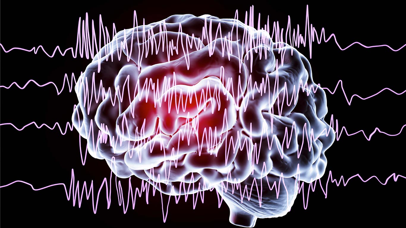 What Are the Epilepsies? - Lompoc Valley Medical Center